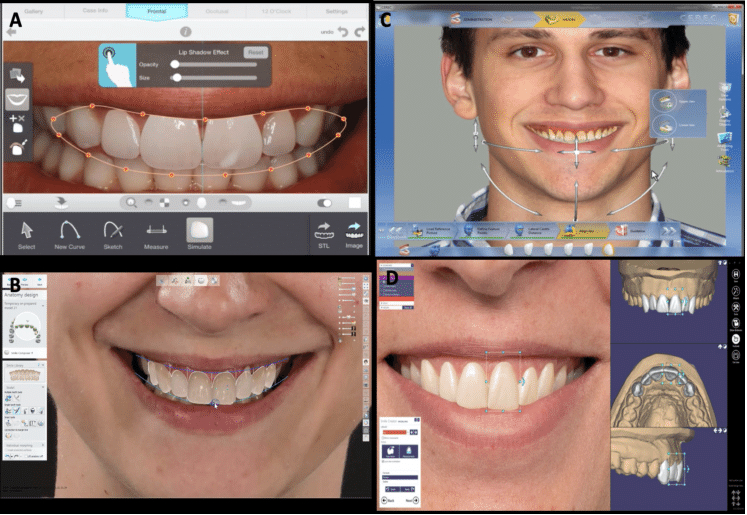 Digital Smile Design Perth | Cosmetic Dental Services | Connolly Dental