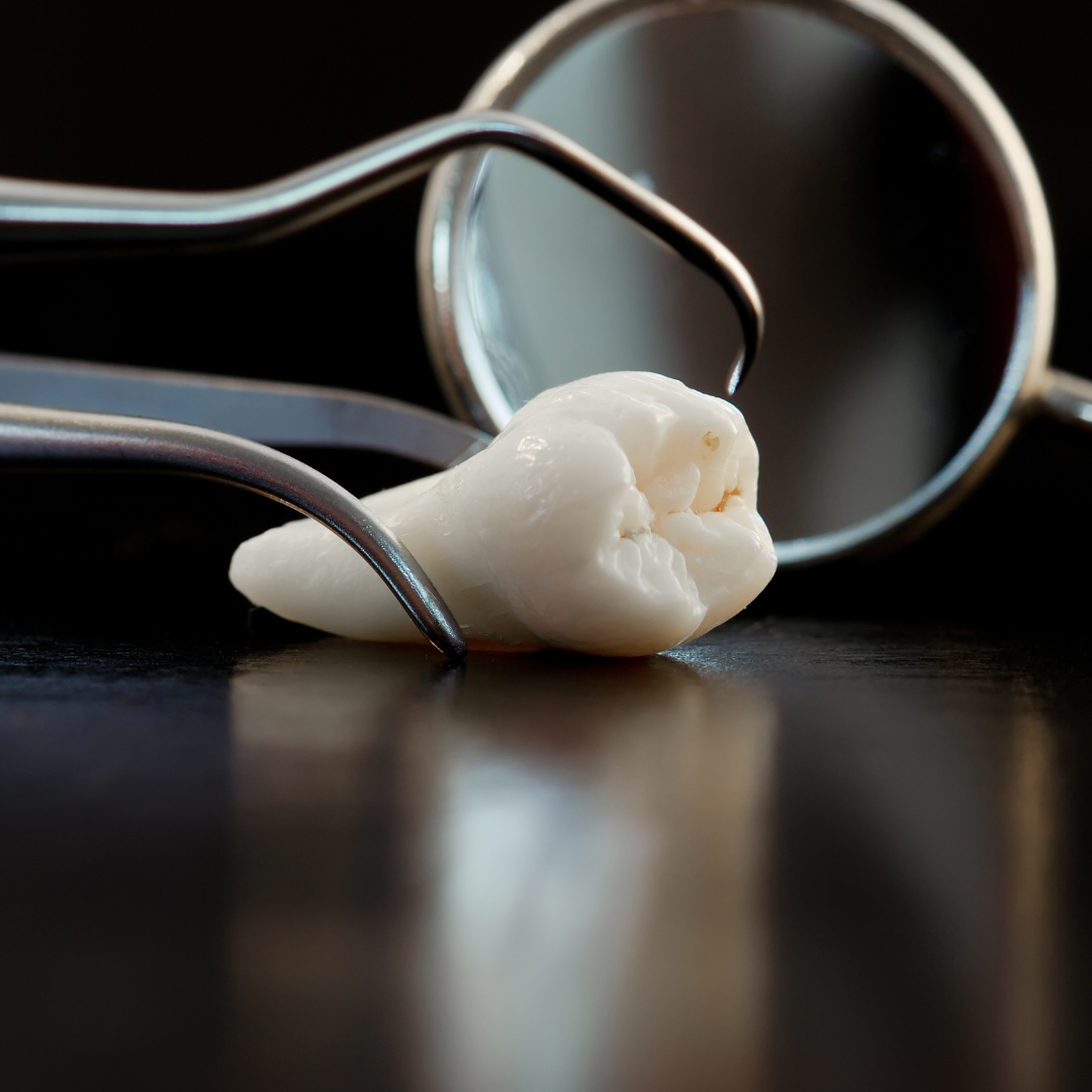 Emergency Tooth Extraction Perth | Same Day Appointment